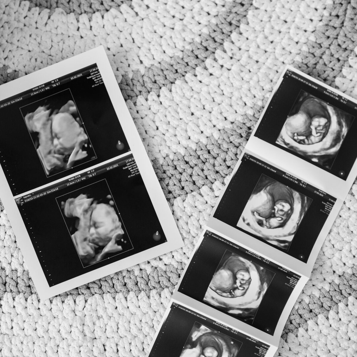 Private Baby Scans in Kent | Fetal Medicine UK